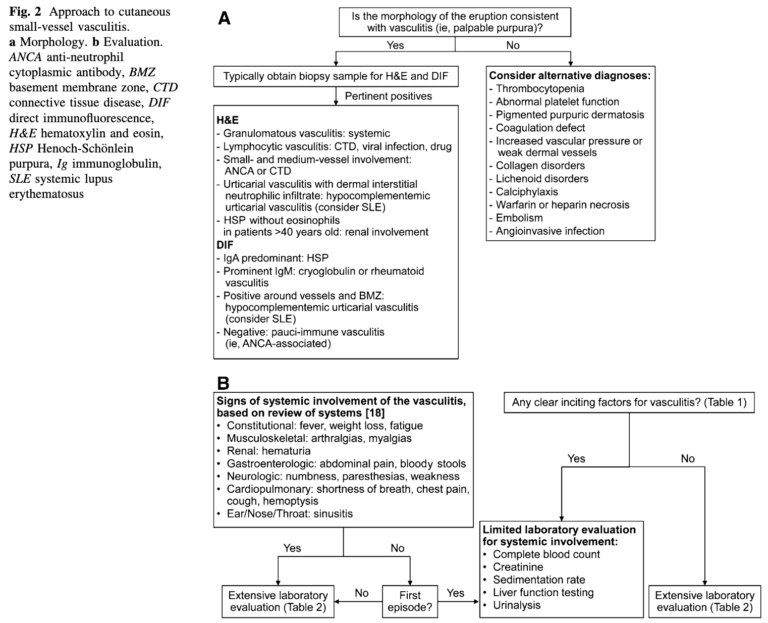 皮膚小血管炎 CSVV cutaneous small vessel vasculitis｜ある内科医のまとめ
