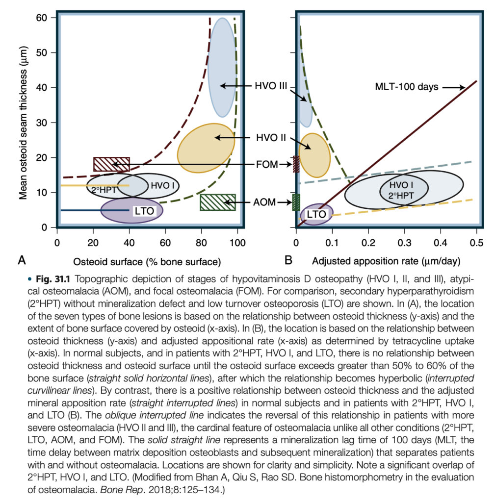 くる病・骨軟化症｜ある内科医のまとめ